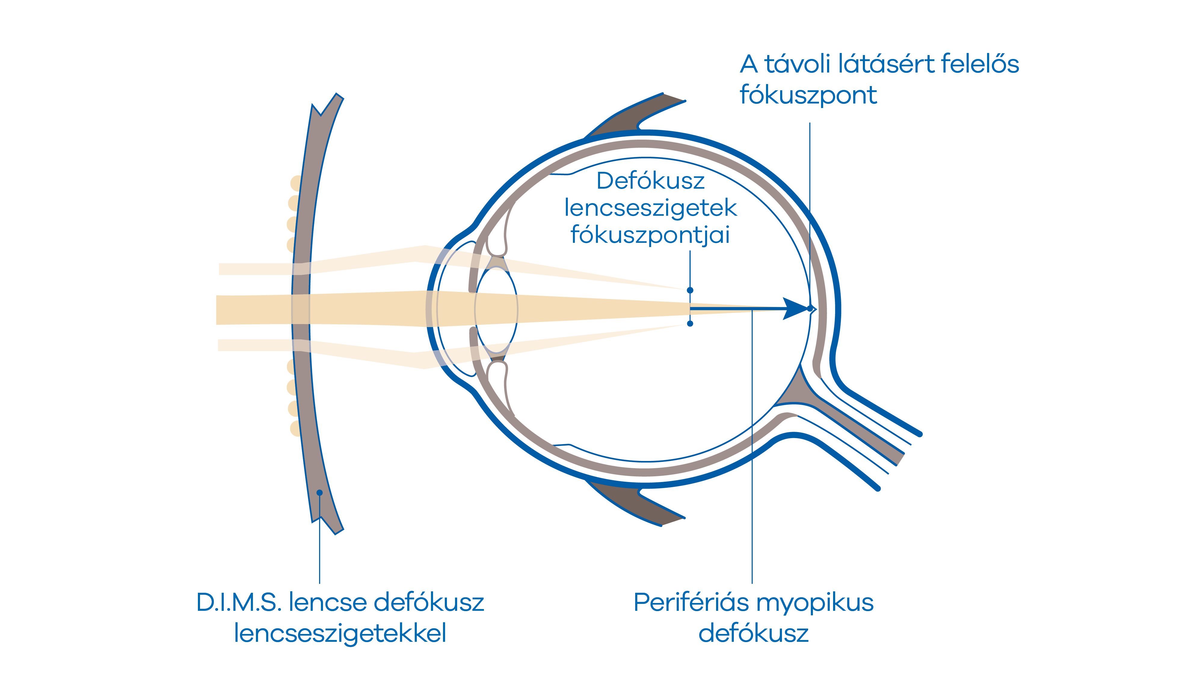 MiYOSMART – Myopia care for kids | Hoya Vision Care